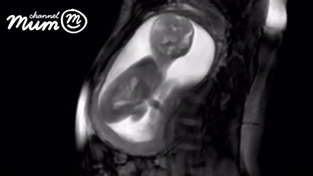 incredible-footage-of-baby-at-20-weeks-mp4 – TheWeeFlea.com